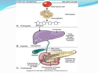 Liver Dialogue for Gynaecologists : Dr Sharda Jain | PPT
