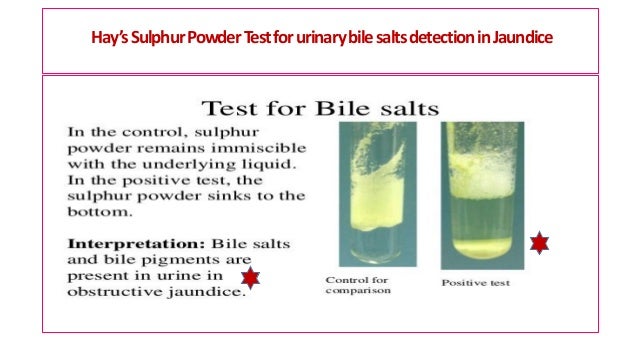 Liver function tests and their clinical applications