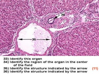 Liver&gall bladder | PPT