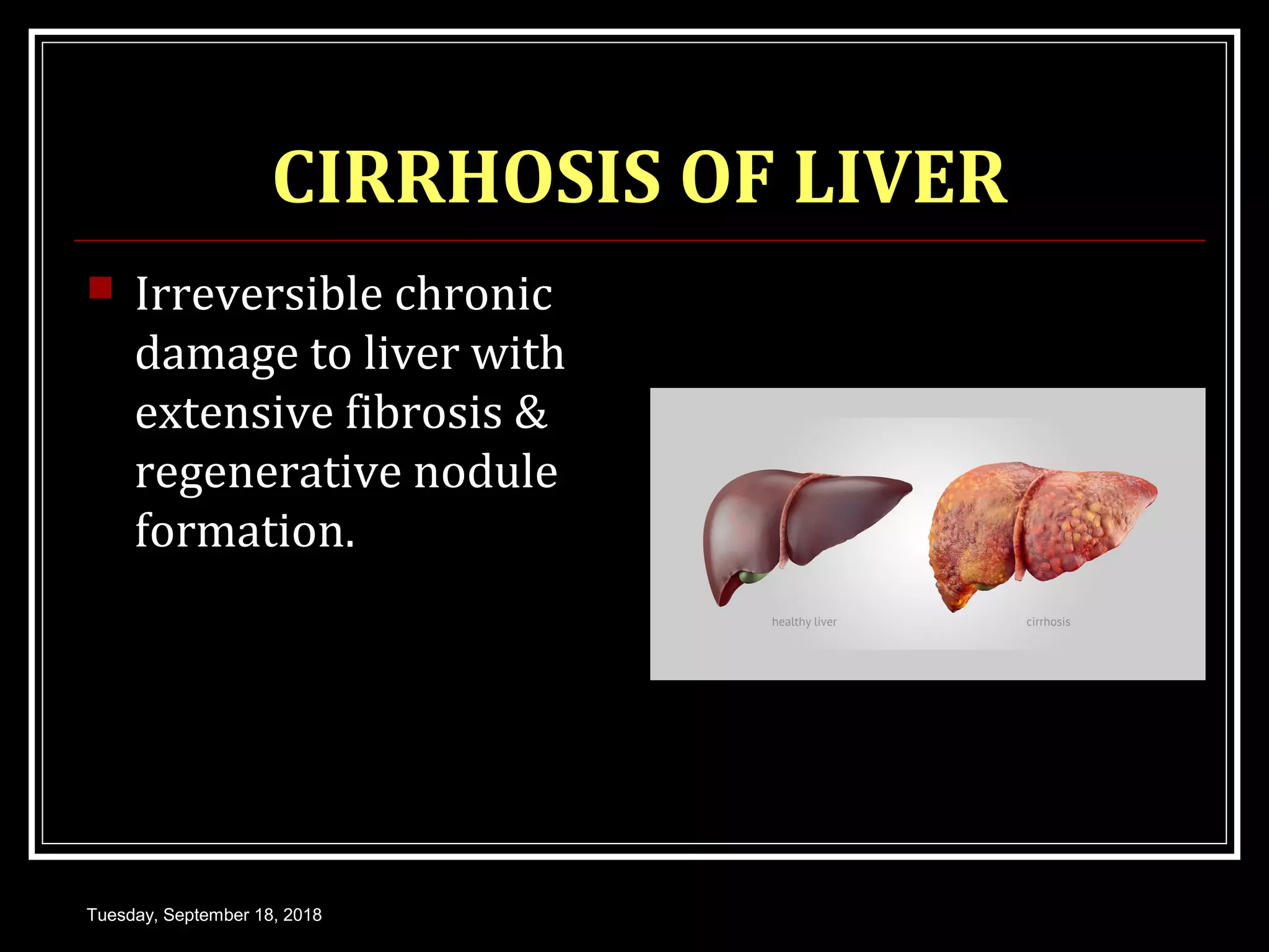 Liver & Gall bladder | PPT