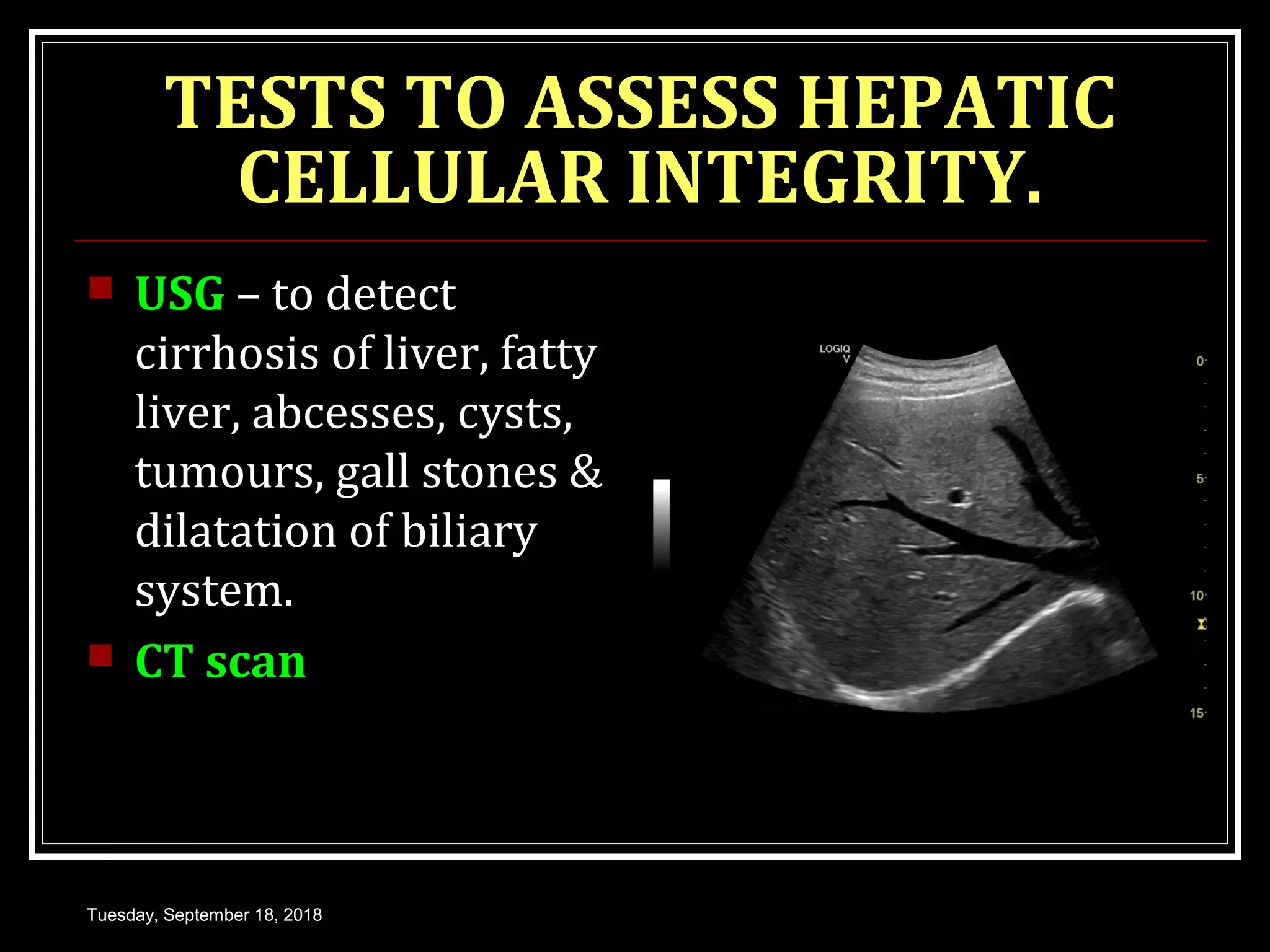 Liver & Gall bladder | PPT