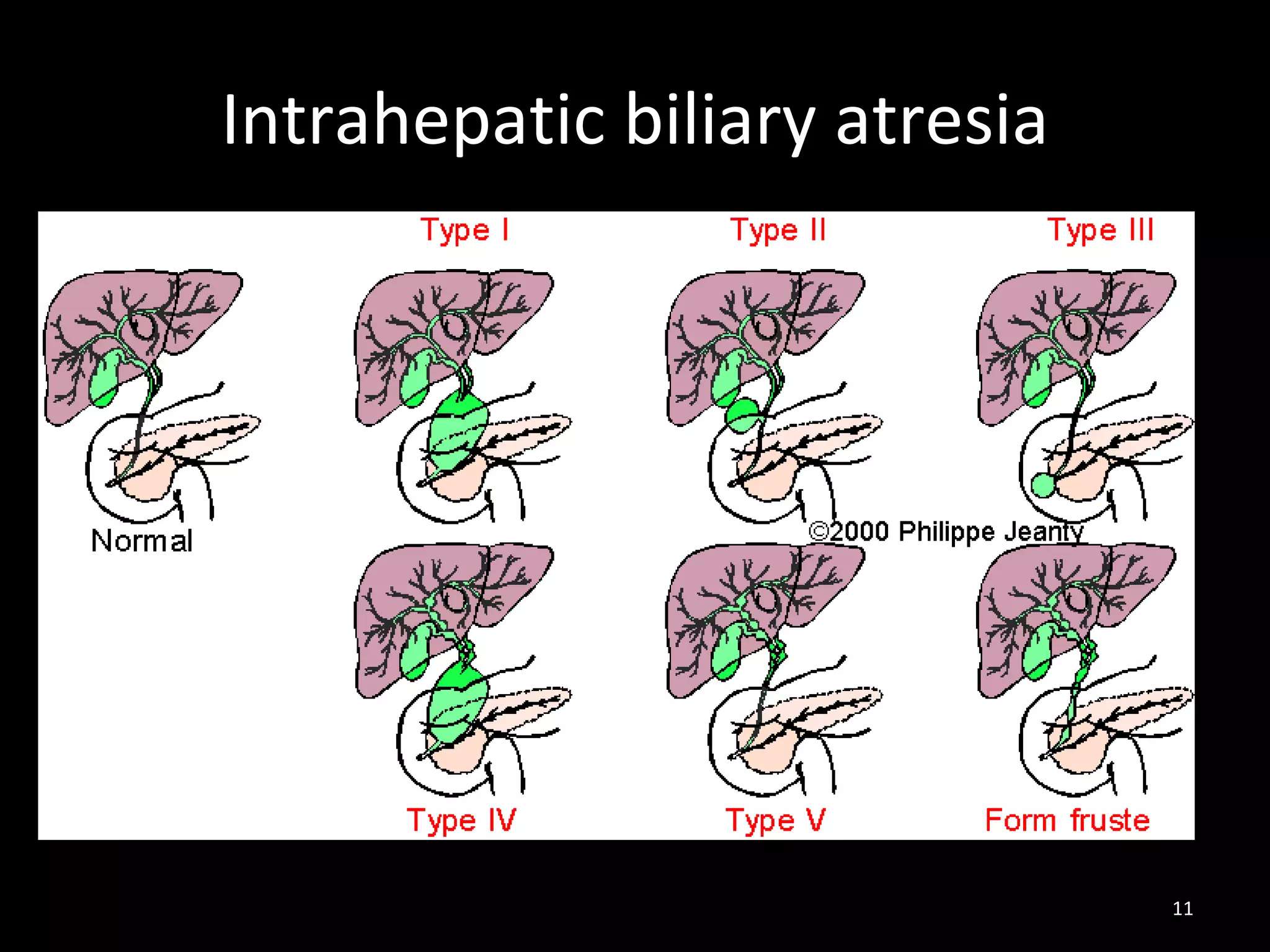 Liver & Hepatobiliary System .pptx