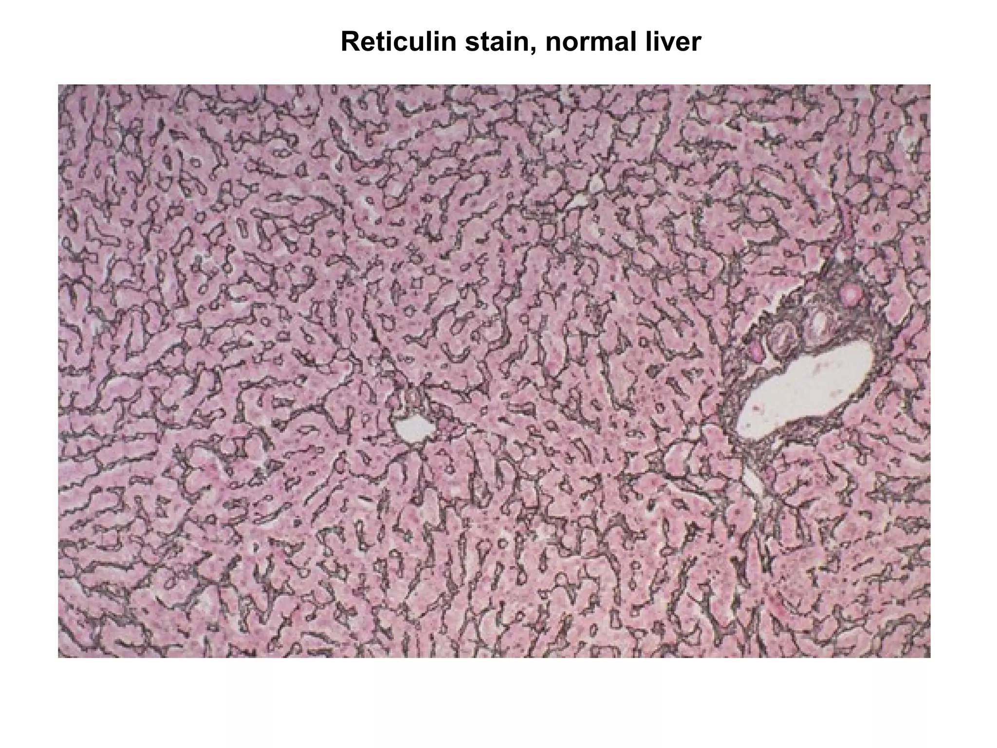 Histology of normal liver | PPT