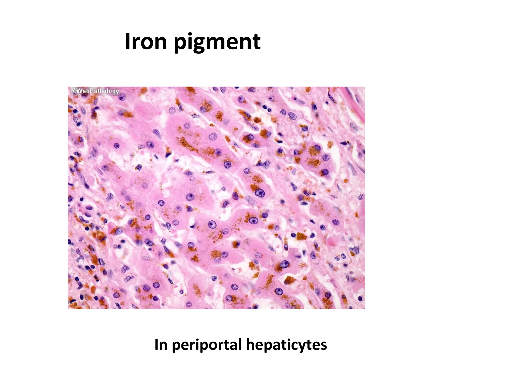 Histology of normal liver | PPT
