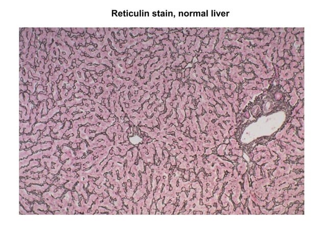 Histology of normal liver | PPT