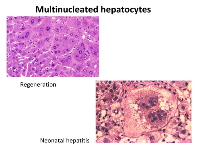Histology of normal liver | PPT