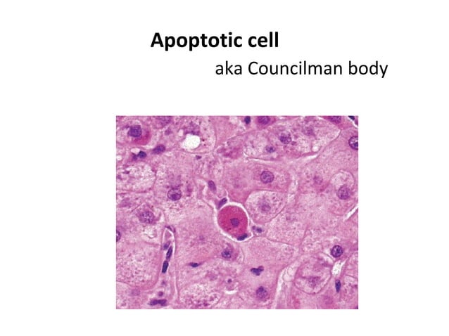 Histology of normal liver | PPT