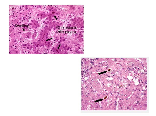 Histology of normal liver | PPT