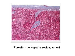 Histology of normal liver | PPT