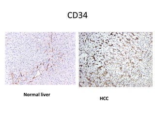 Histology of normal liver | PPT