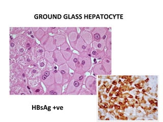 Hepatocyte Histology