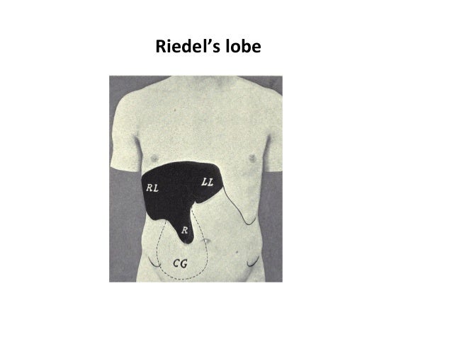 Histology of normal liver