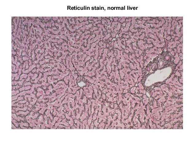 Histology of normal liver
