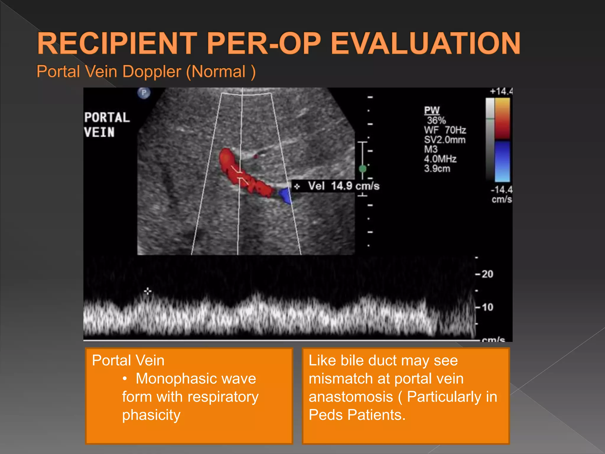 Liver imaging ct scan algorithm | PPTX