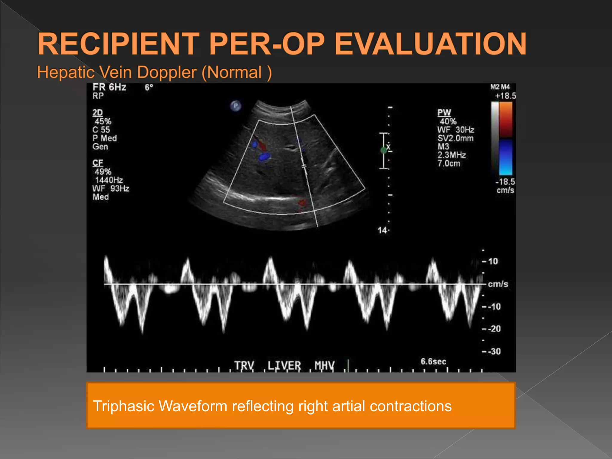 Liver imaging ct scan algorithm | PPTX