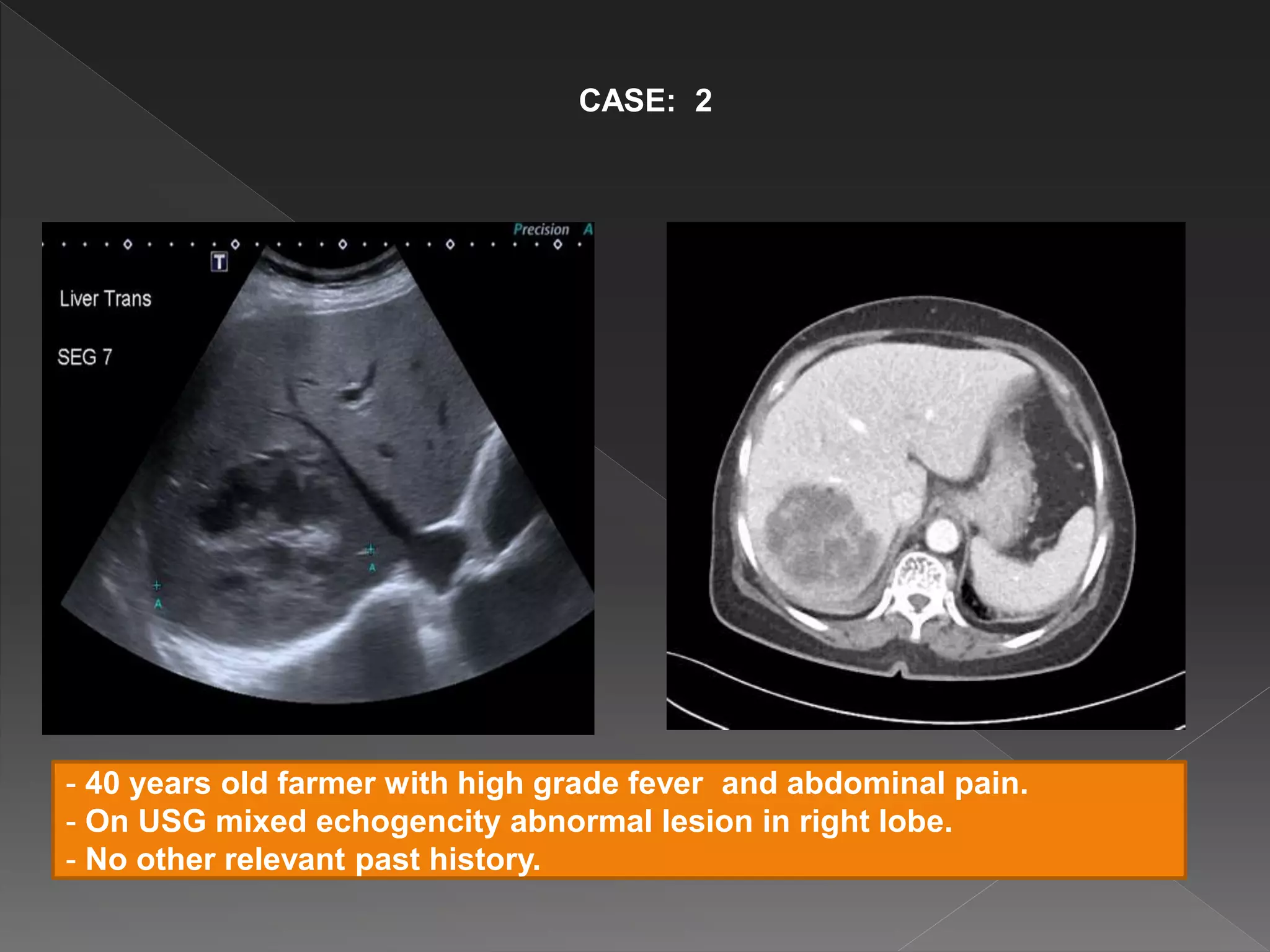 Liver imaging ct scan algorithm | PPTX