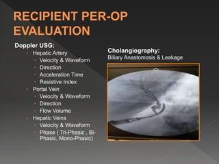 Liver imaging ct scan algorithm | PPTX