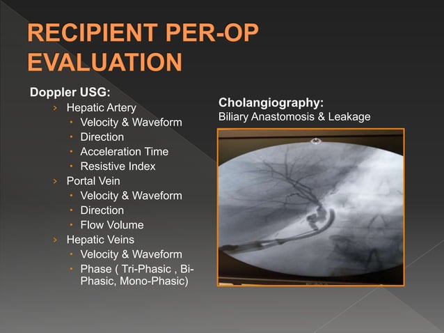 Liver imaging ct scan algorithm | PPTX | Lung and Respiratory Health | Diseases and Conditions