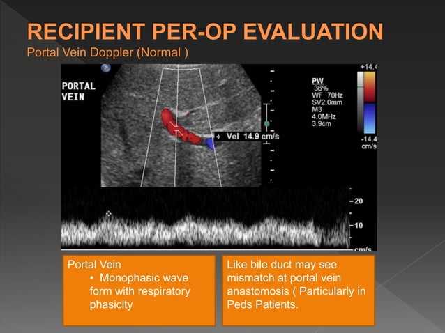 Liver imaging ct scan algorithm | PPTX | Lung and Respiratory Health ...