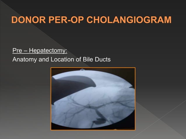 Liver imaging ct scan algorithm | PPTX | Lung and Respiratory Health ...