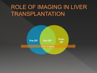 Liver imaging ct scan algorithm | PPTX
