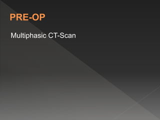 Liver imaging ct scan algorithm | PPTX