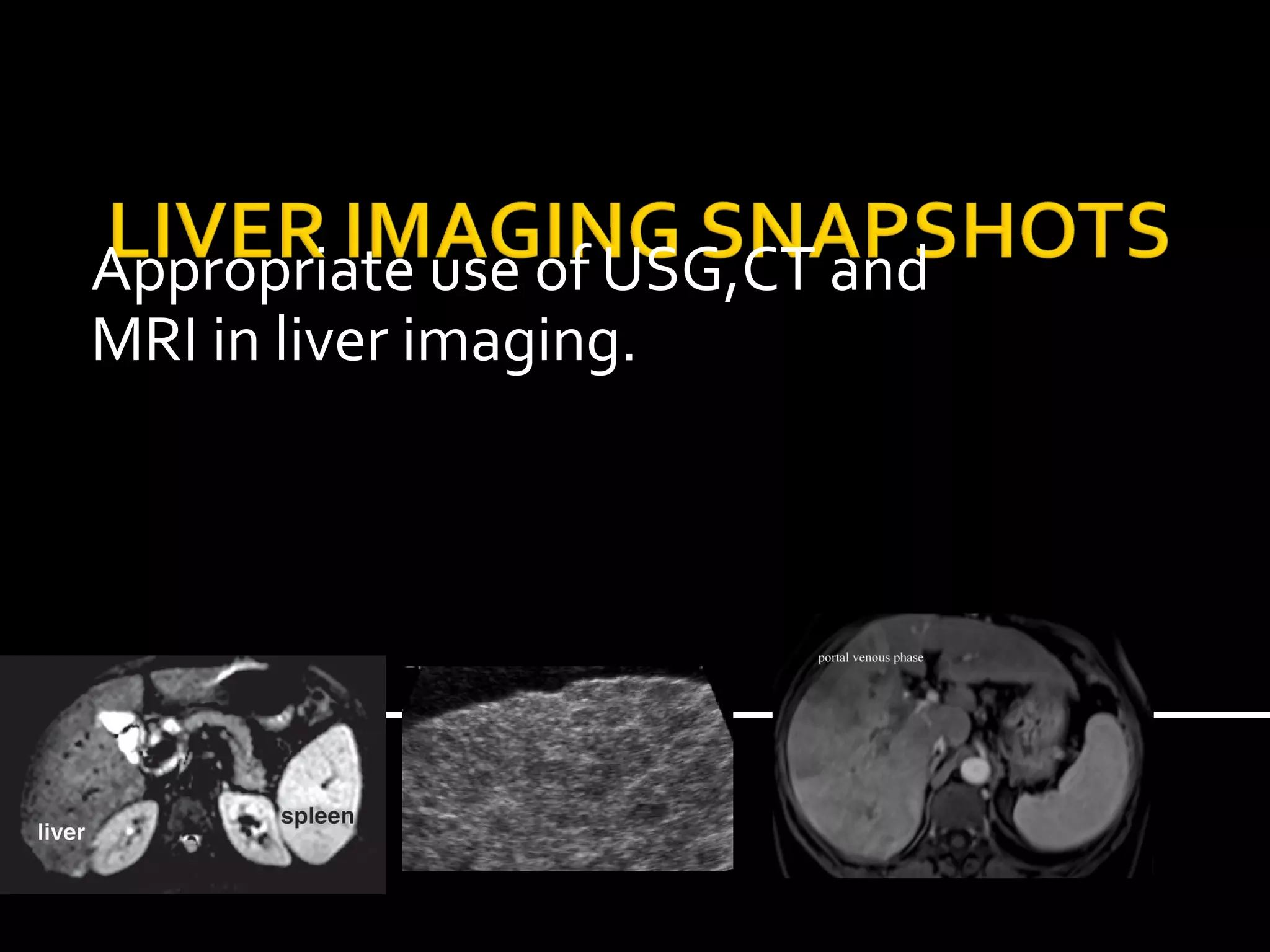 Liver imaging snapshots role of CT USG MRI in liver imaging. | PPT
