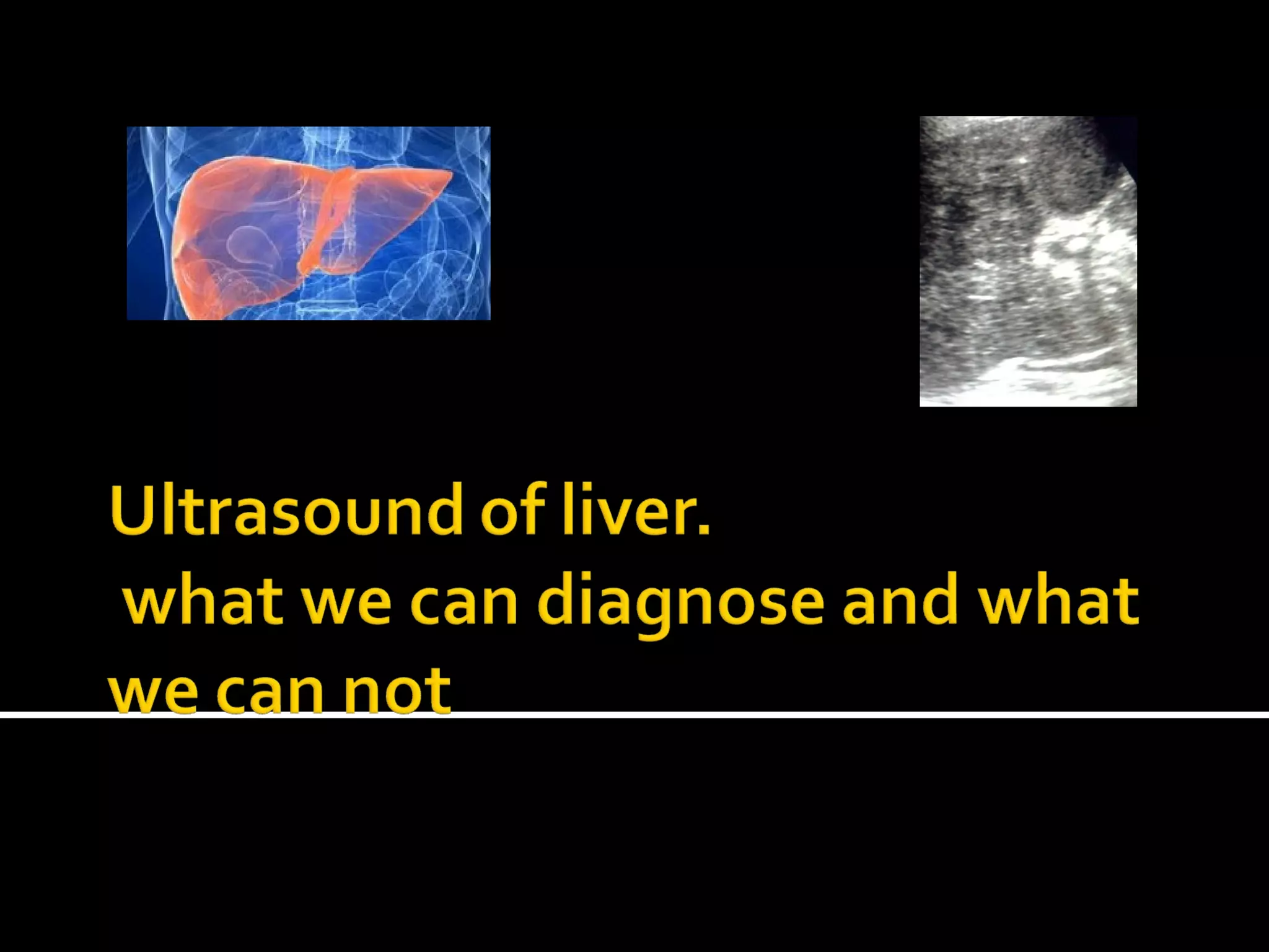 Liver imaging snapshots role of CT USG MRI in liver imaging. | PPT