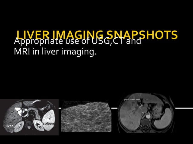 Liver imaging snapshots role of CT USG MRI in liver imaging. | PPT