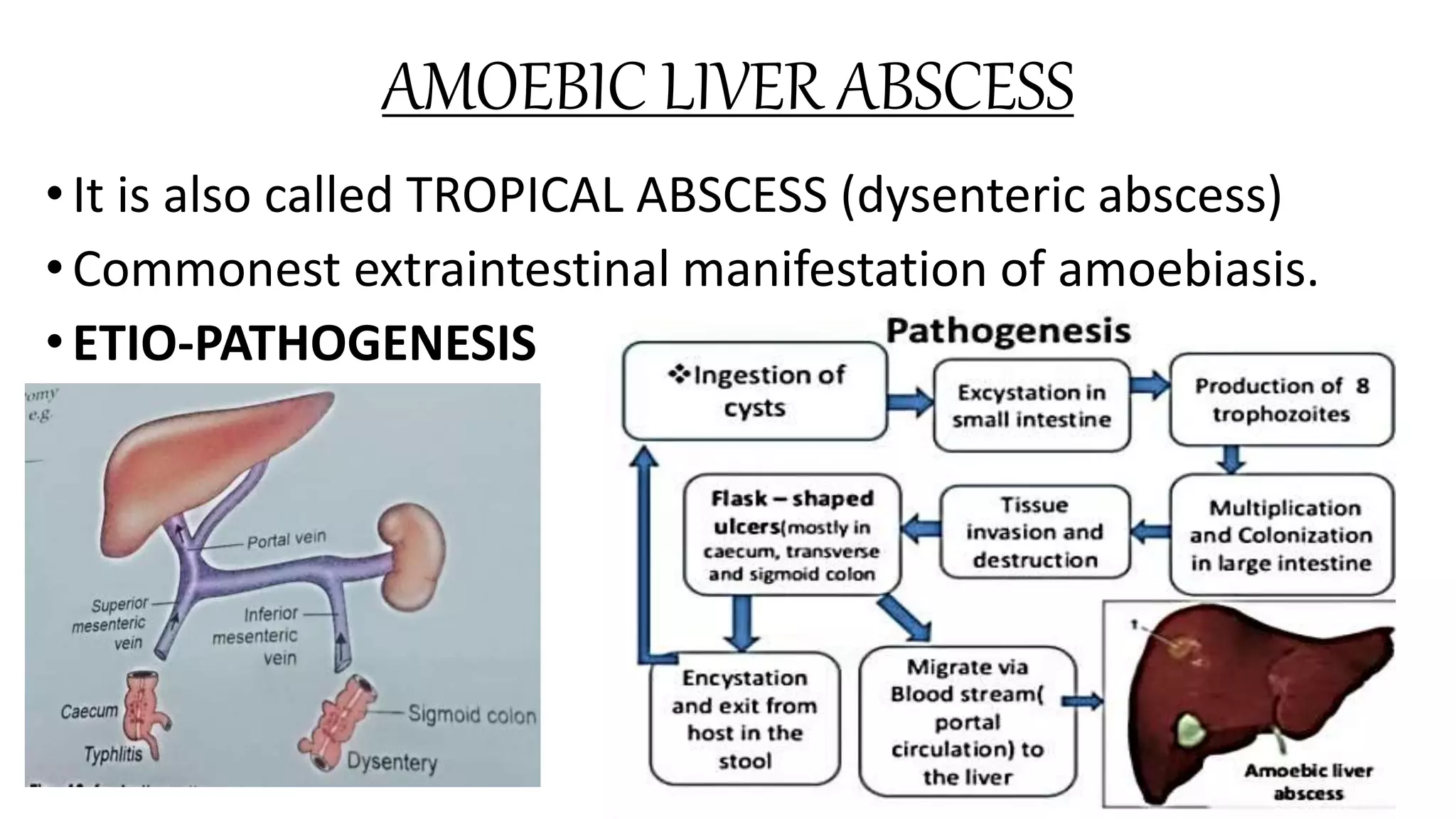 LIVER INFECTIONS.pptx
