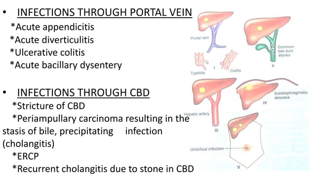 LIVER INFECTIONS.pptx | Digestive Disorders | Diseases and Conditions