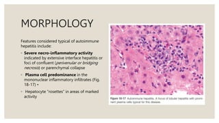 Liver injury-2.pptx bxjdndannsmxmfmsmmssmzmzm | PPTX