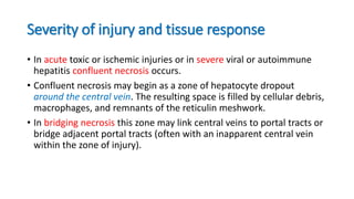liver injury.pptx jhfvbghhbbnnnnbcdddvhhhhh | PPT