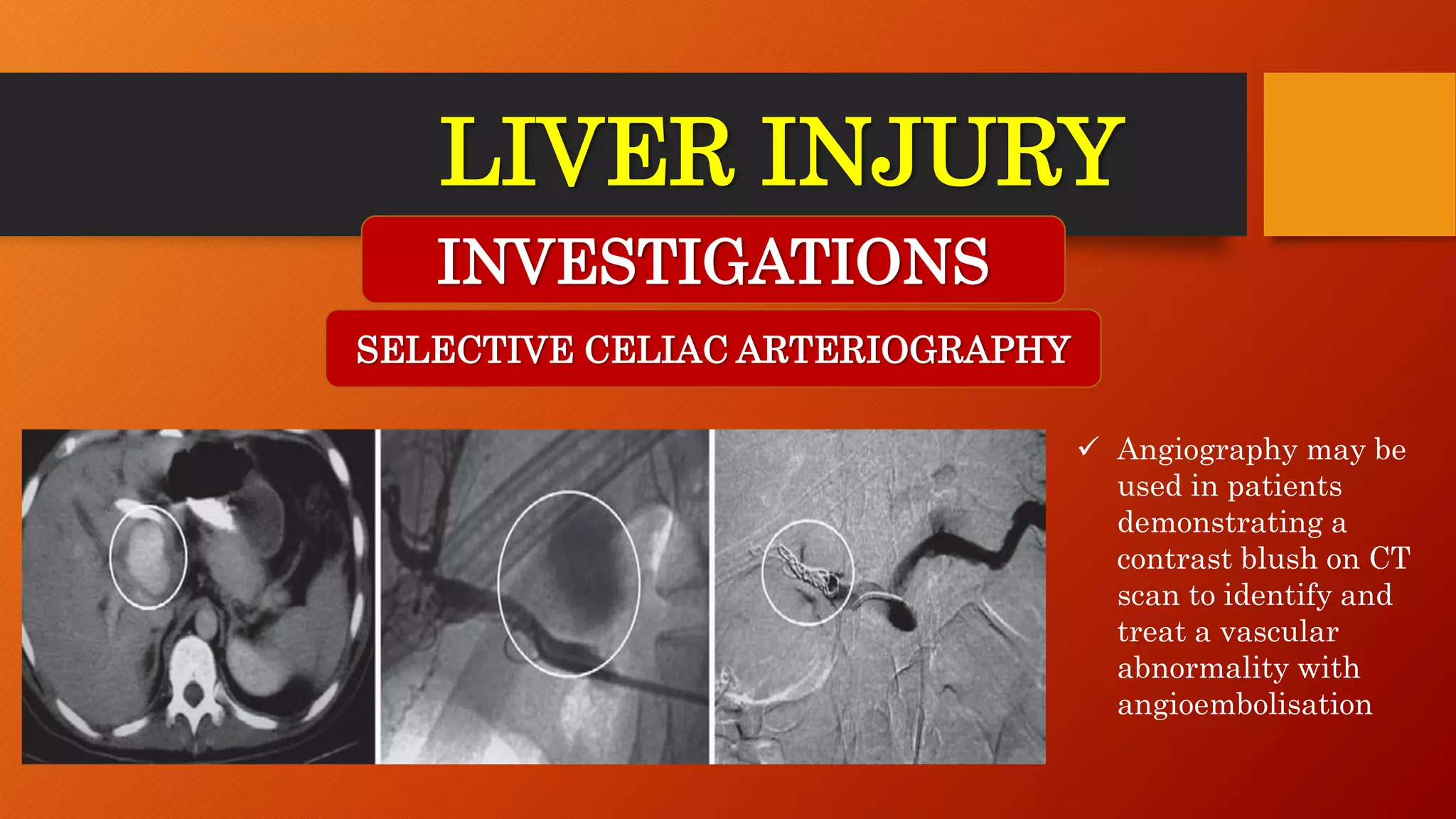 LIVER INJURY- TRAUMA SURGERY.pptx