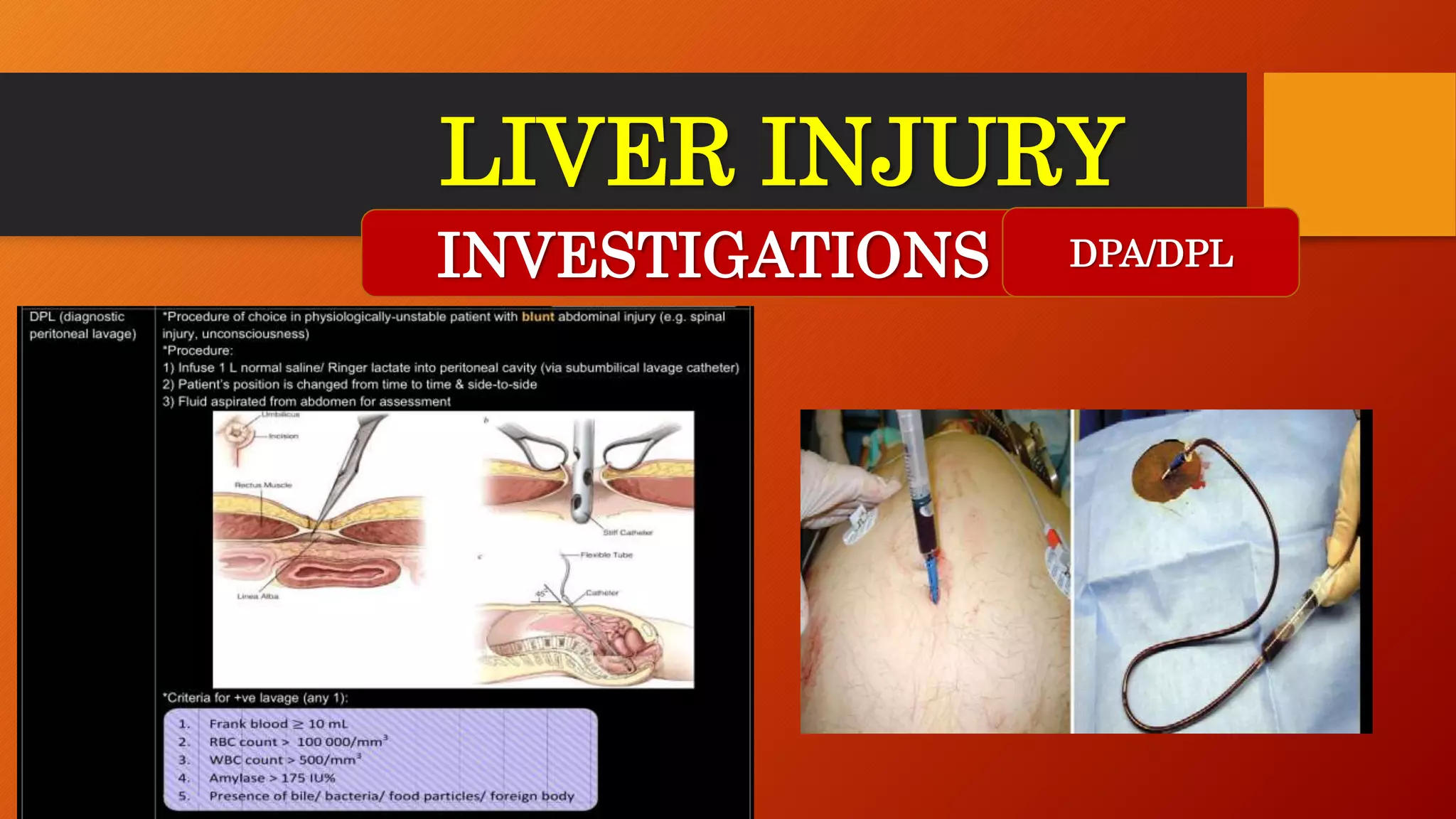 LIVER INJURY- TRAUMA SURGERY.pptx