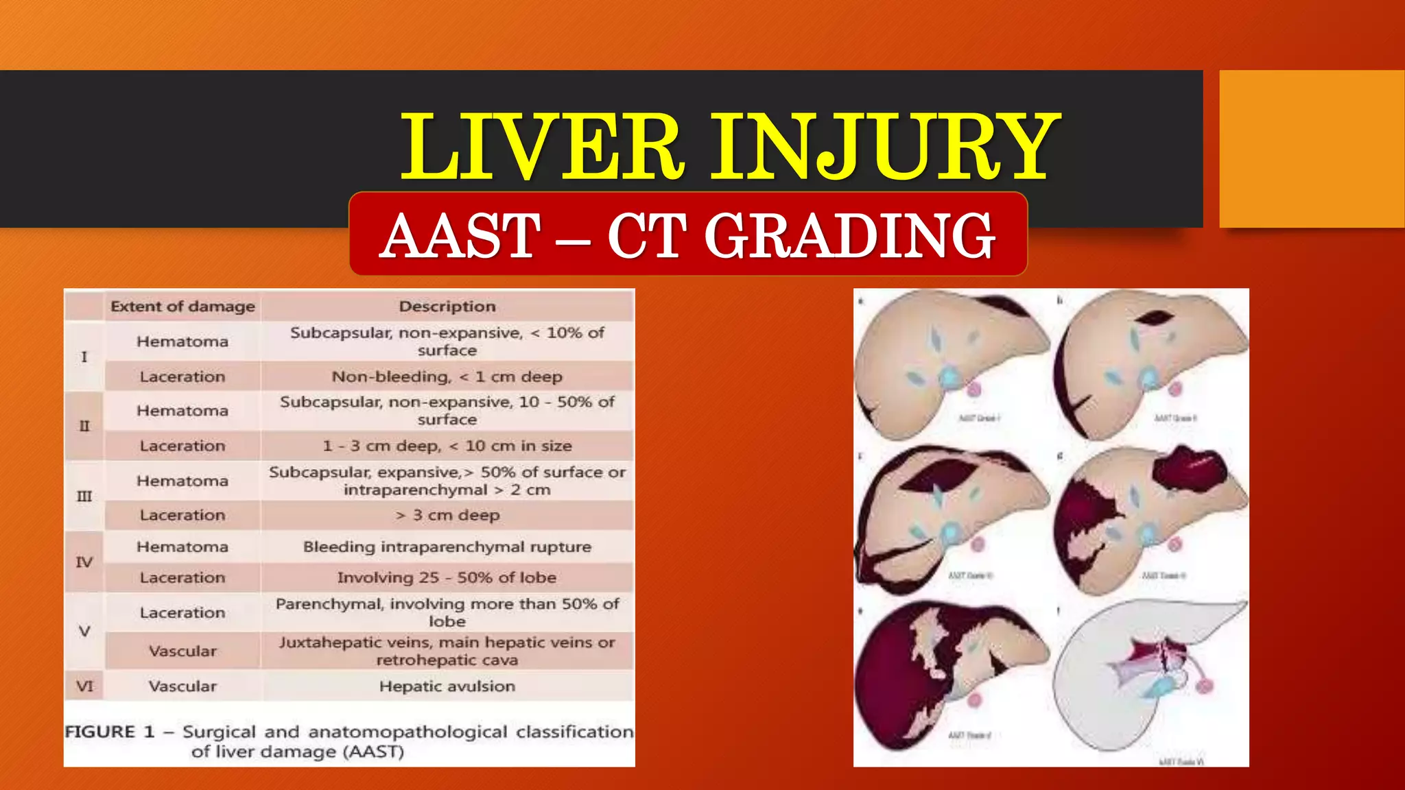 LIVER INJURY- TRAUMA SURGERY.pptx
