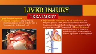 LIVER INJURY- TRAUMA SURGERY.pptx