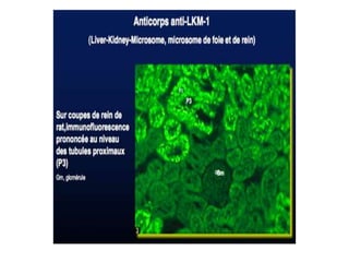 Liver kidney microsomal antibody | PPTX