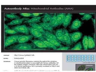 Liver kidney microsomal antibody | PPT | Free Download