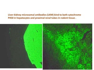 Liver kidney microsomal antibody | PPTX