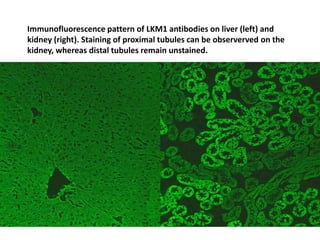 Liver kidney microsomal antibody | PPTX