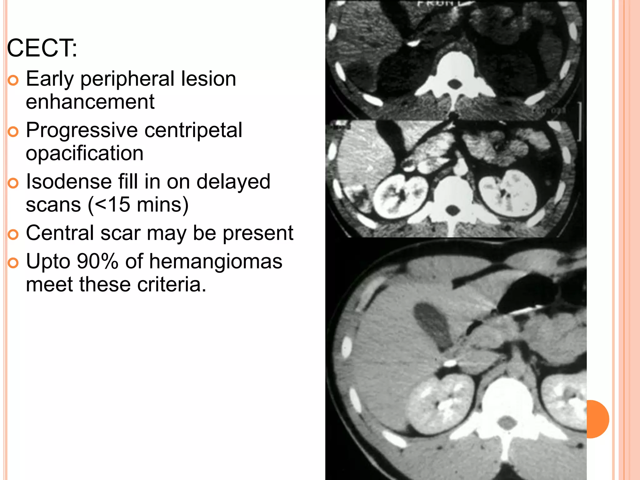 Liver lesions SYMPOSIUM RADIOLOGY | PPTX