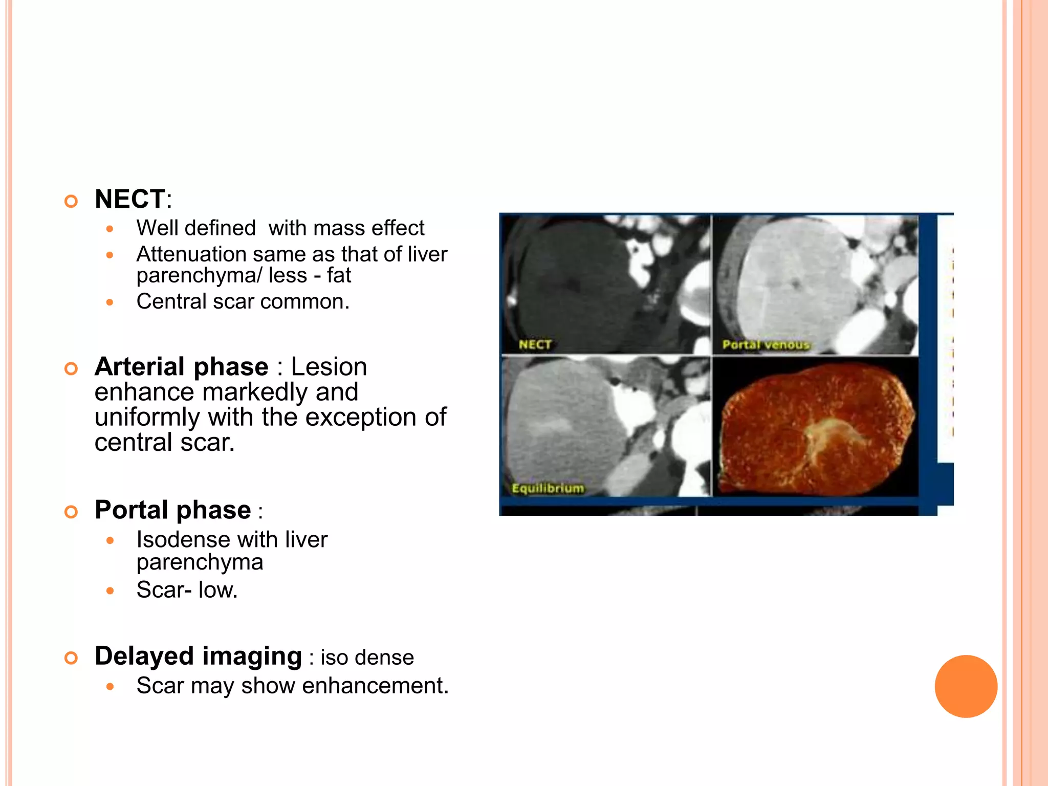 Liver lesions SYMPOSIUM RADIOLOGY | PPTX