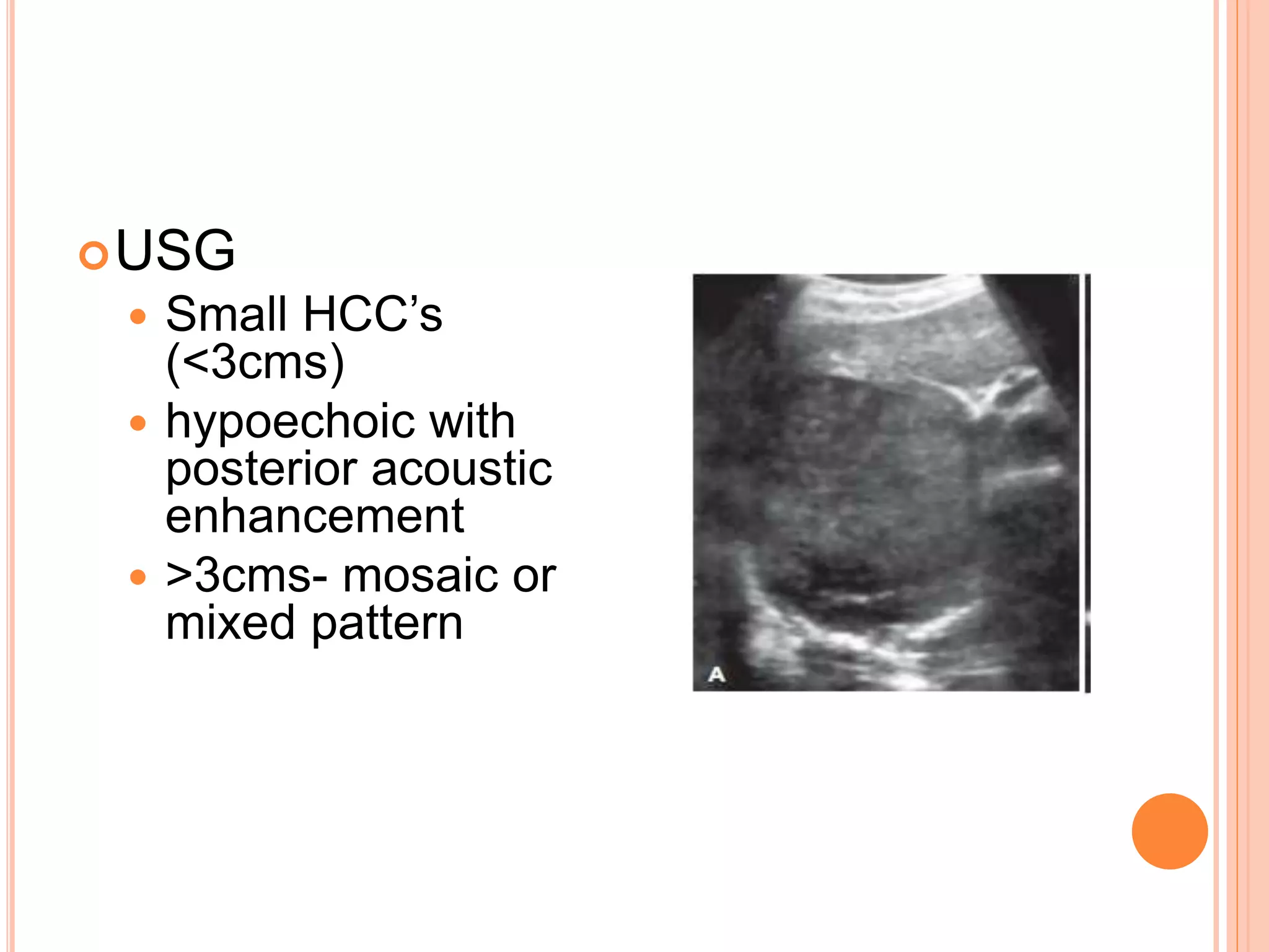 Liver lesions SYMPOSIUM RADIOLOGY | PPTX