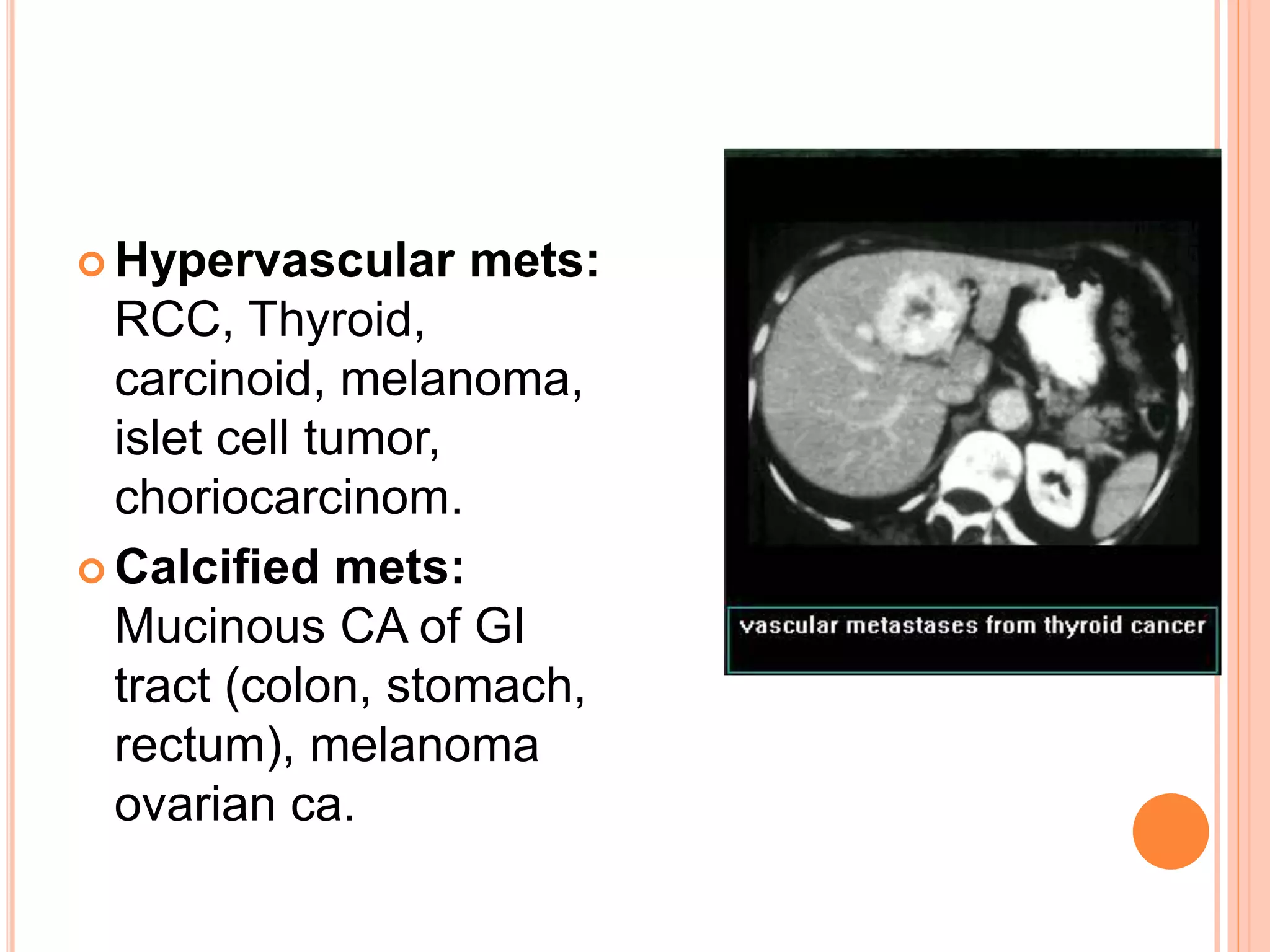 Liver lesions SYMPOSIUM RADIOLOGY | PPTX