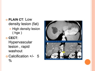 Liver lesions SYMPOSIUM RADIOLOGY | PPTX