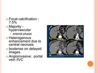 Liver lesions SYMPOSIUM RADIOLOGY | PPTX