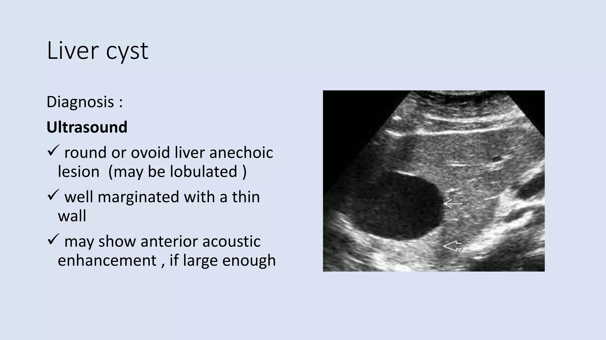 Liver lesions benign and malignant and treatment options.pptx