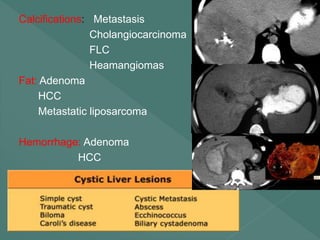Liver lesions bhaskar | PPTX
