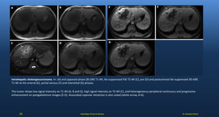 Liver lesions on mri | PDF